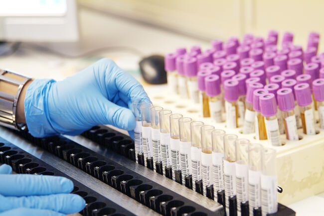 Rhesus-Faktor-Test | BIG direkt gesund